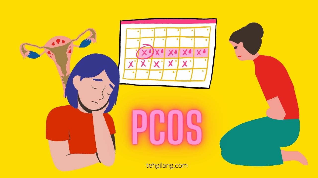 PCOS Adalah Gangguan Menstruasi Yang Perlu Diwaspadai